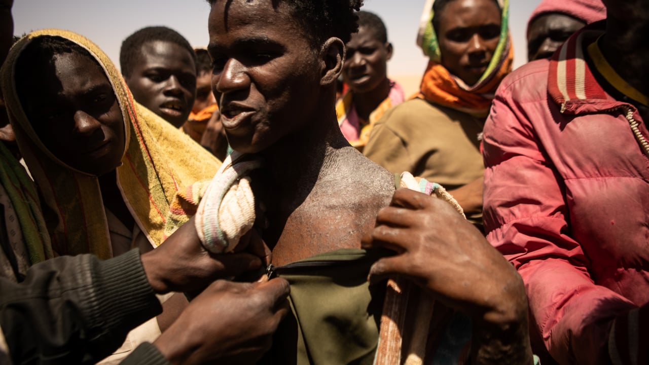 Tackling neglected tropical diseases will help Africa thrive - The ...